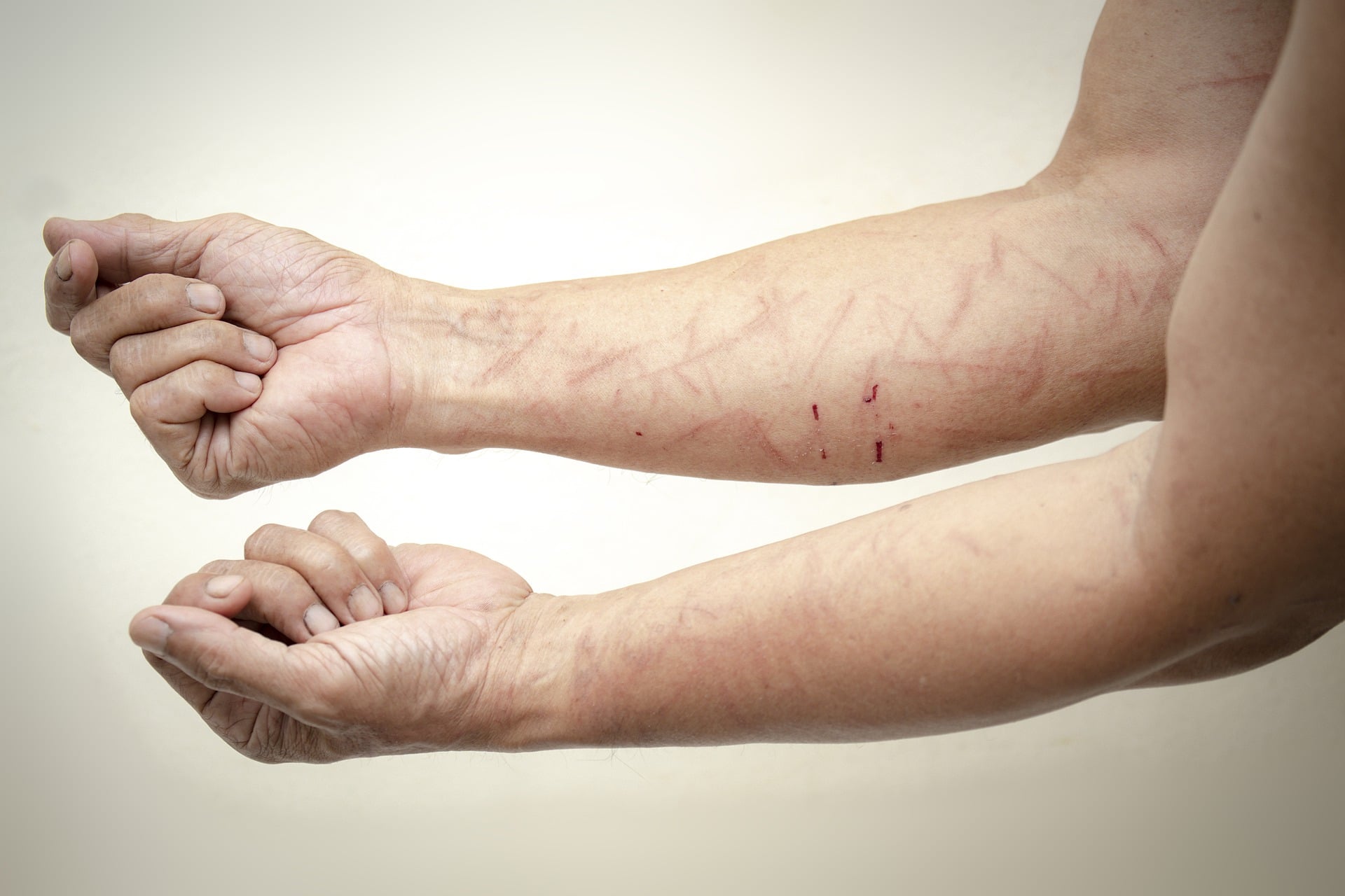 Borderline - Leben zwischen den Extremen